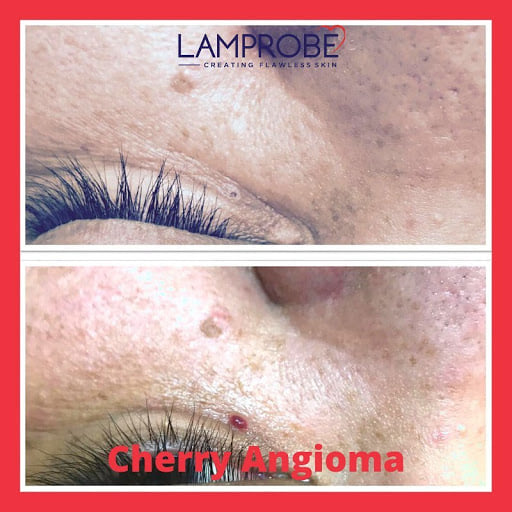 Skin irregularities - noninvasive method | Violet Skin Boutique